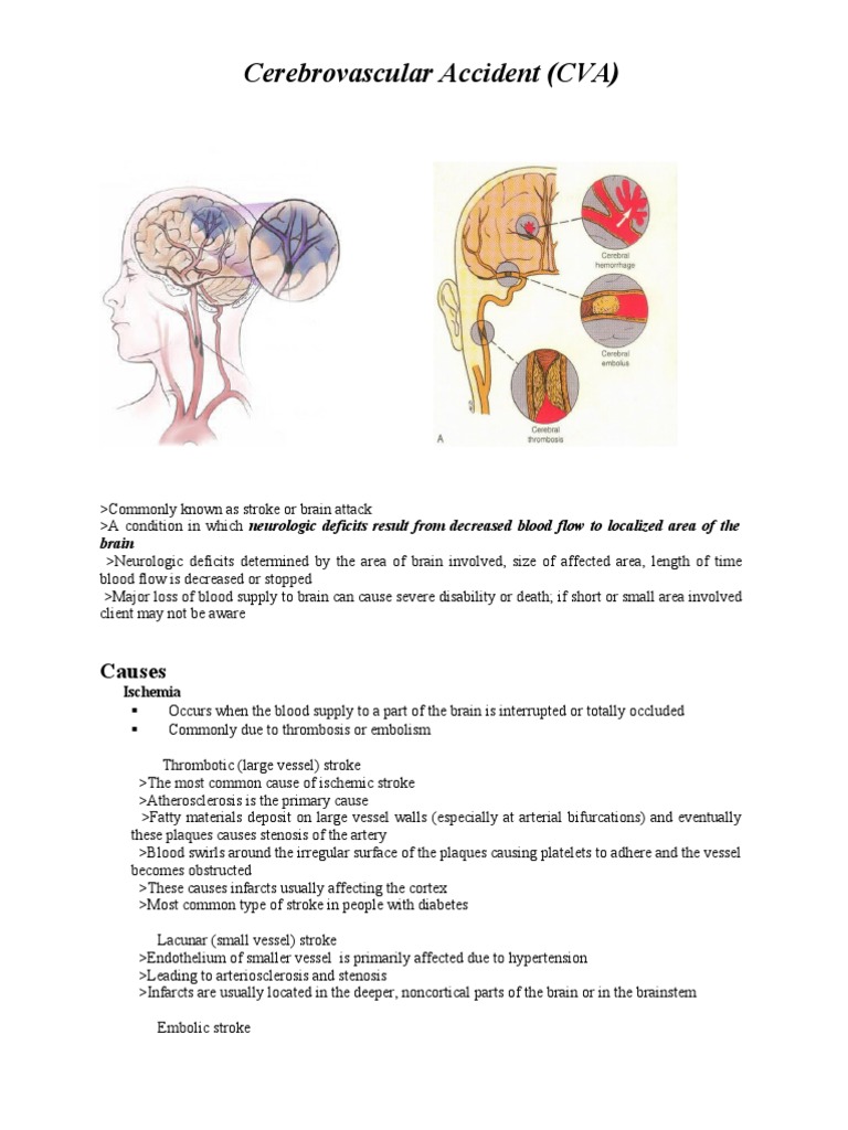 Case Study Cva | Stroke | Thrombosis