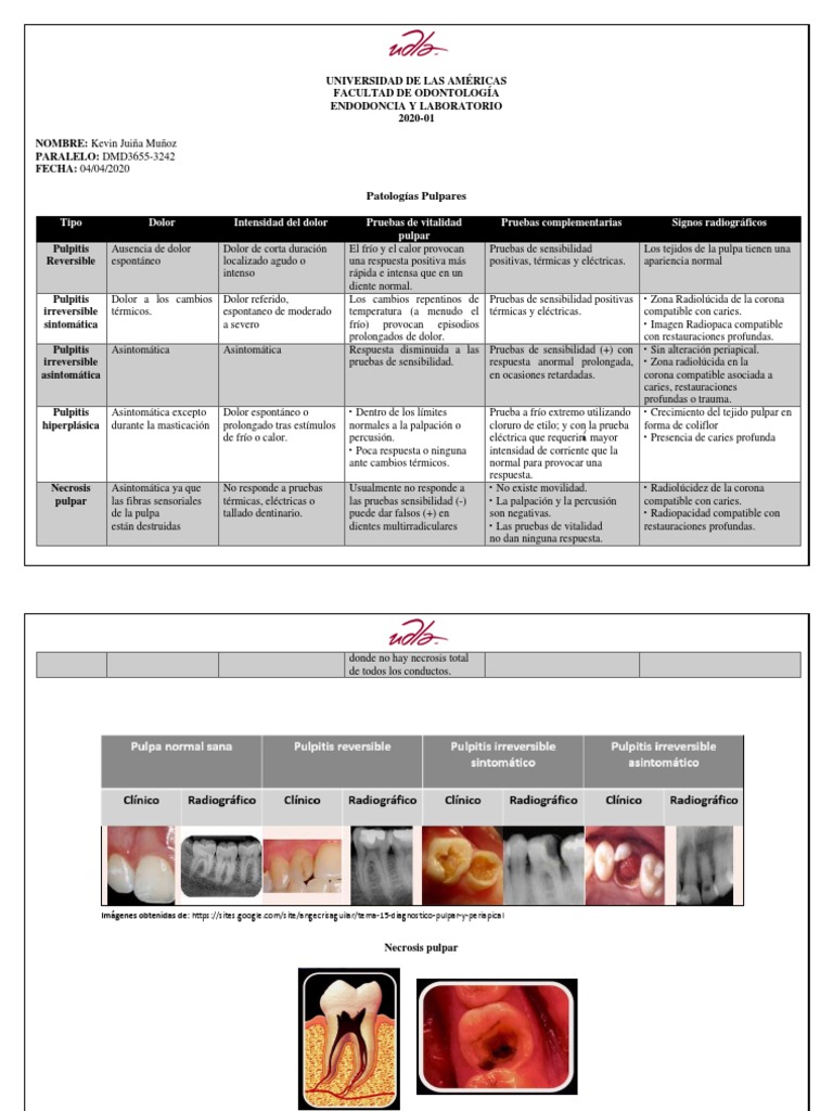 Cuadro de Patologias Pulpares y Periapicales PDF | PDF | Dolor | Especialidades Medicas