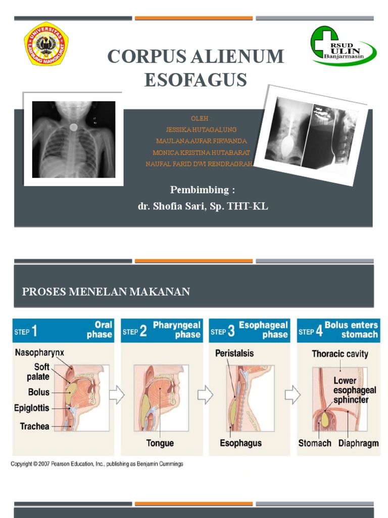 Corpal Sal. Cerna | PDF