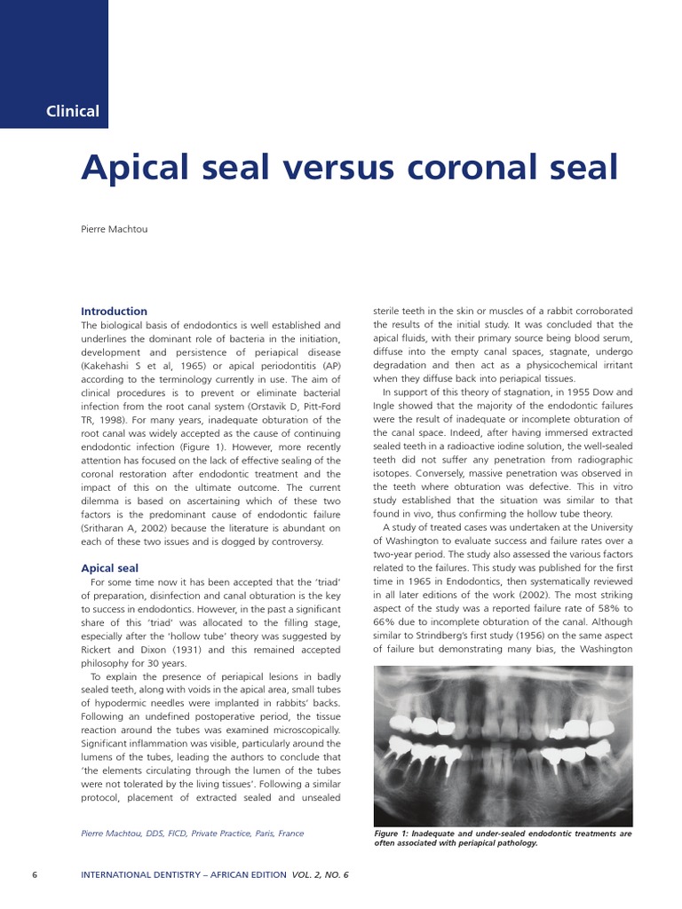 Apical Vs Coronal Seal Machtou | PDF | Mouth | Dentistry