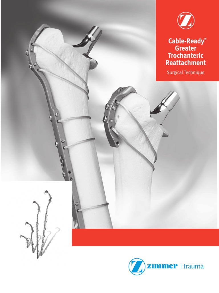 Cable-Ready Greater Trochanteric Reattachment: Surgical Technique | PDF ...