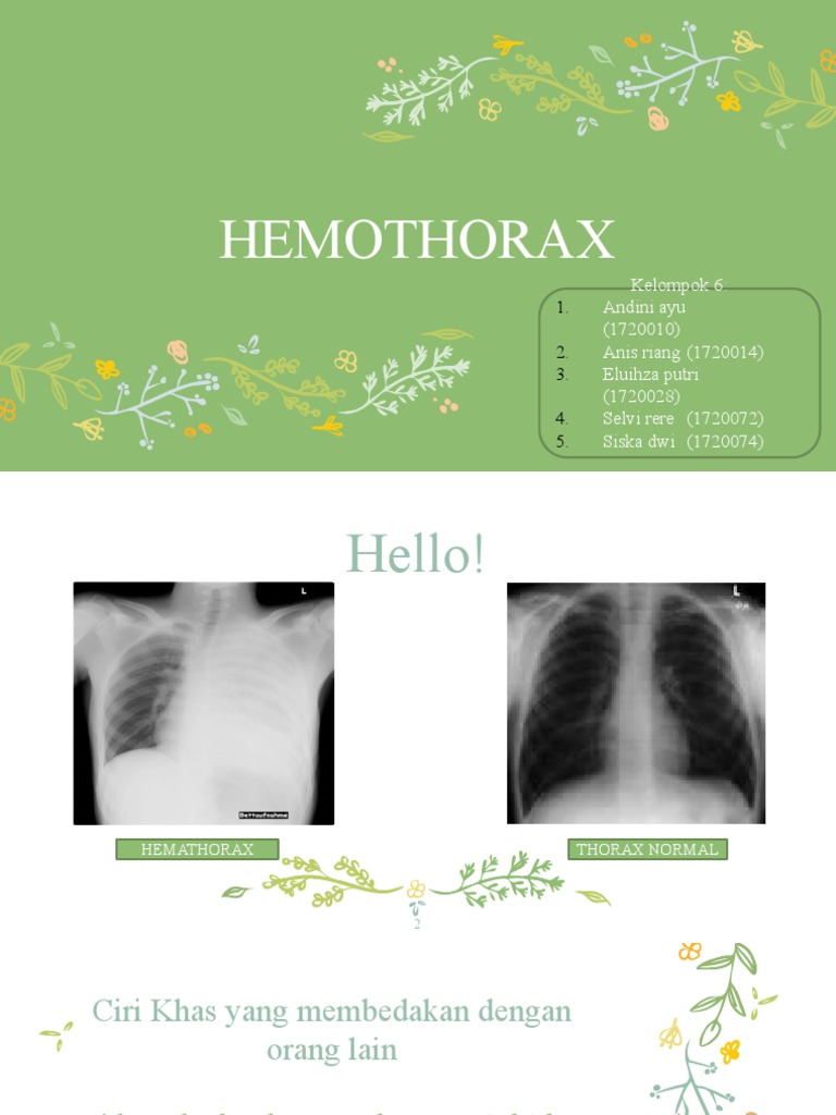 6 Kelompok Hemothorax | PDF