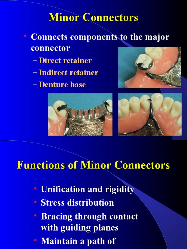 Connects Components To The Major Connector: Minor Connectors | PDF ...