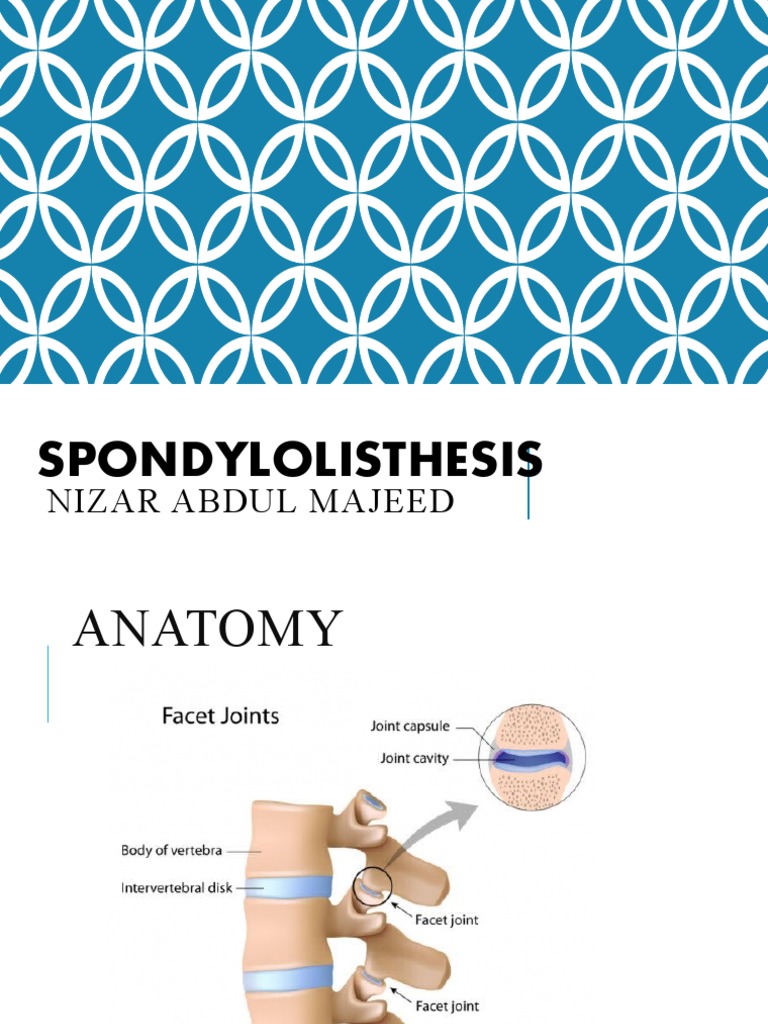 SPONDYLOLISTHESIS EXERCISES AND MANAGEMENT | PDF | Vertebral Column | Vertebra