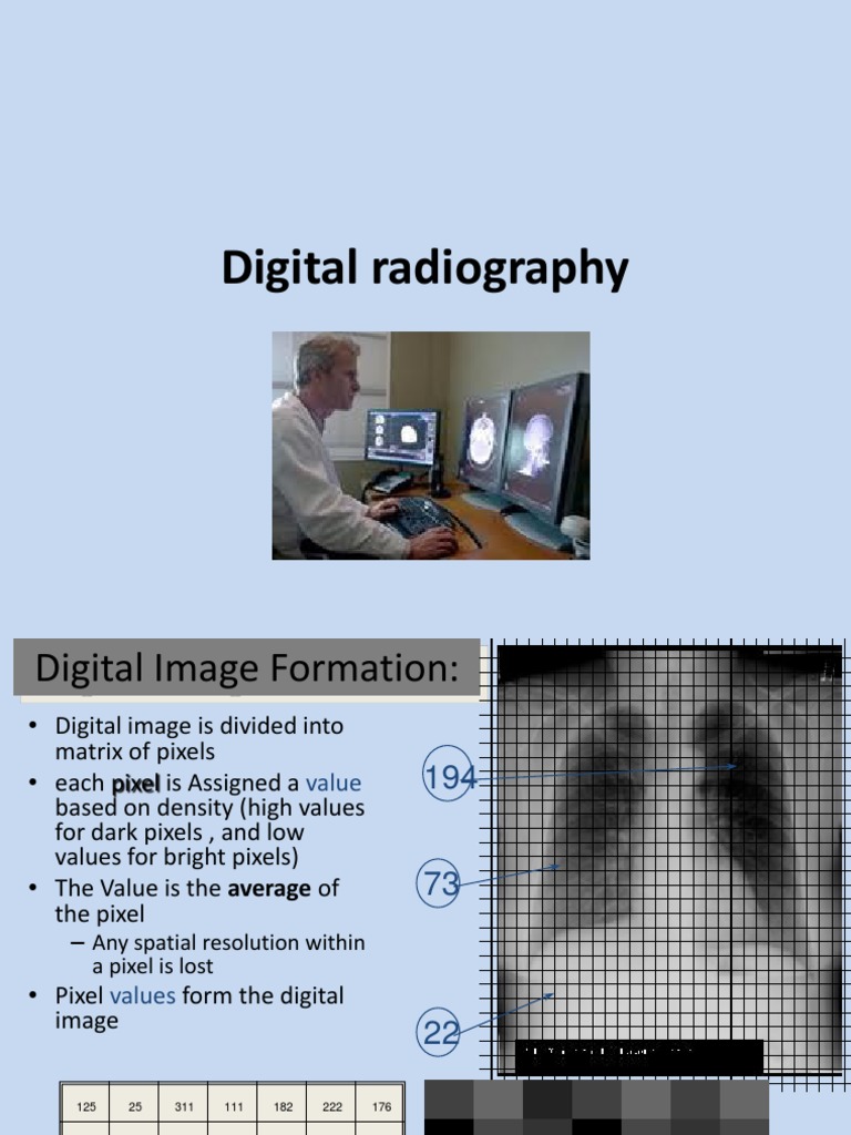 Physics 4 | PDF | Charge Coupled Device | Radiography