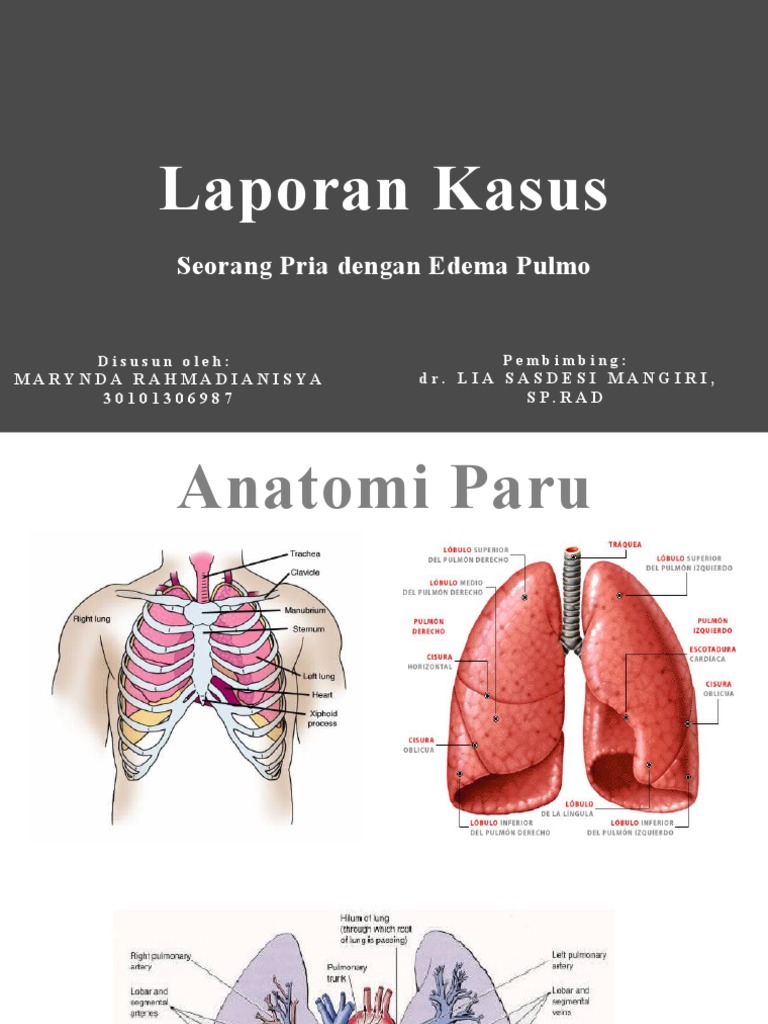 Laporan Kasus Edem Pulmo | PDF