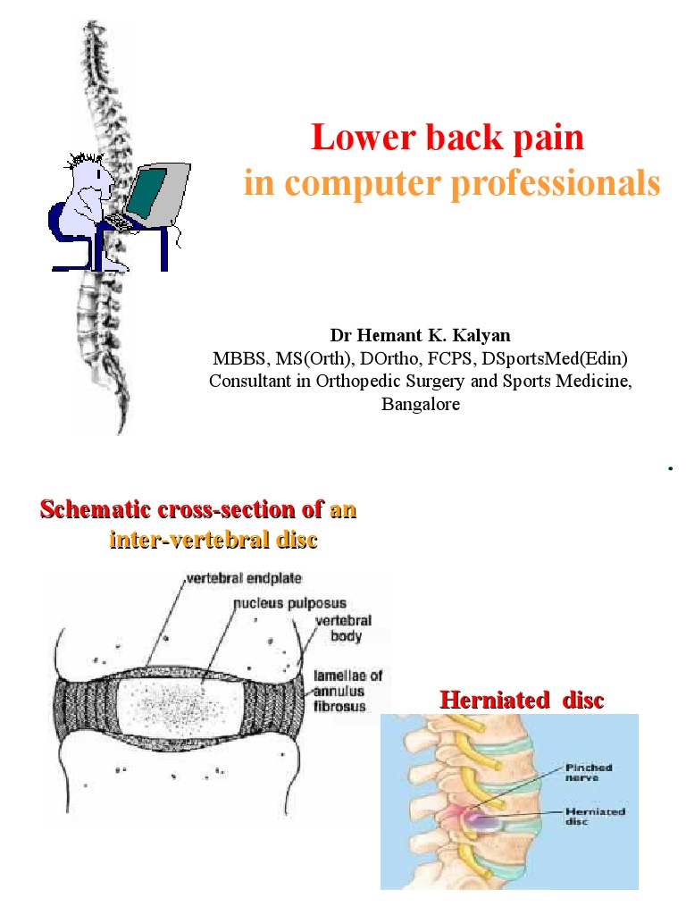 Lower Back Pain: in Computer Professionals | Download Free PDF | Back ...