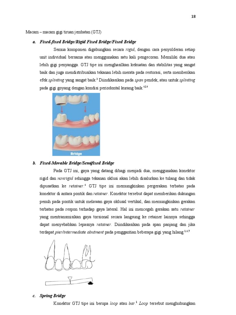 Macam Macam GTJ | PDF