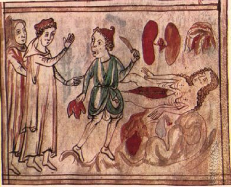 Medieval Dissection | PDF