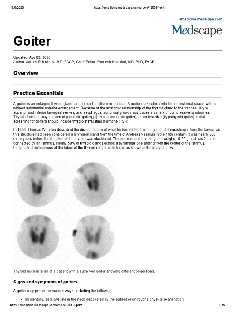 Goiter: Signs and Symptoms of Goiters | PDF