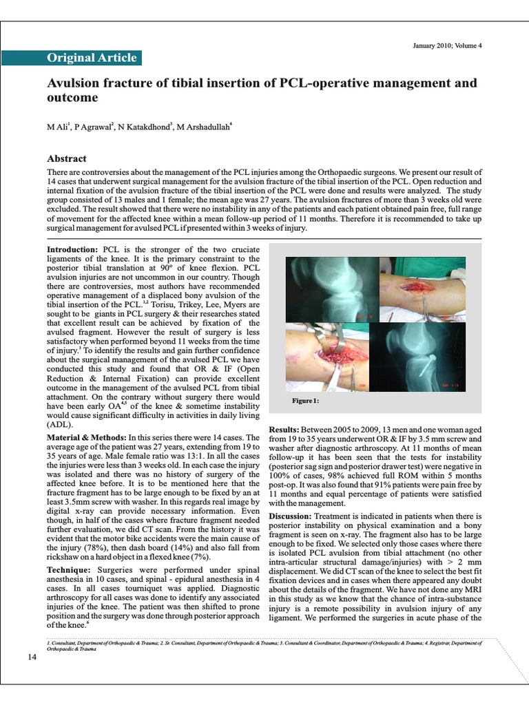 Pcl Avulsion Fracture 2 Pdf Knee Clinical Medicine