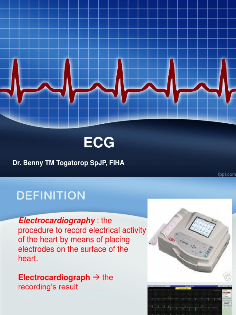 K10. Ekg | PDF | Electrocardiography | Cardiovascular Physiology