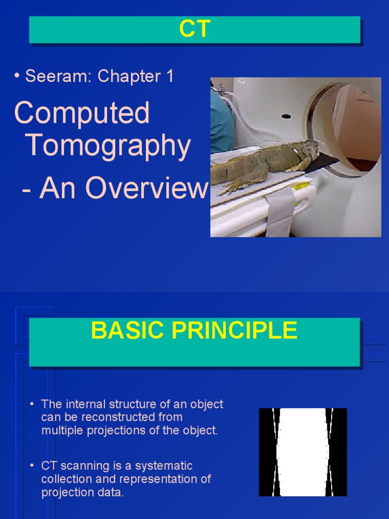 Computed Tomography - An Overview: - Seeram: Chapter 1 | PDF ...