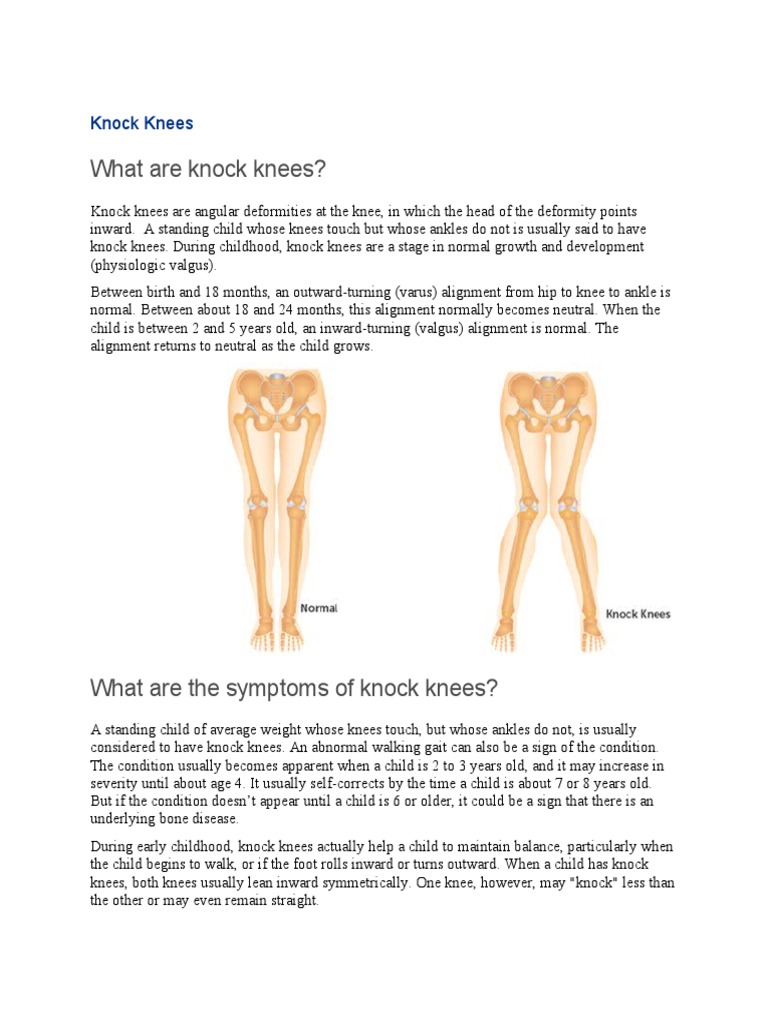 What Are Knock Knees? | PDF | Lower Limb Anatomy | Musculoskeletal System