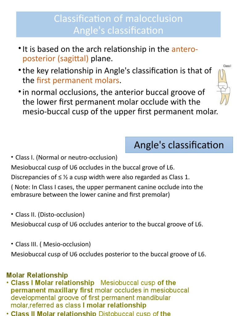Classification of Malocclusion Angle's Classification: Antero-Posterior ...