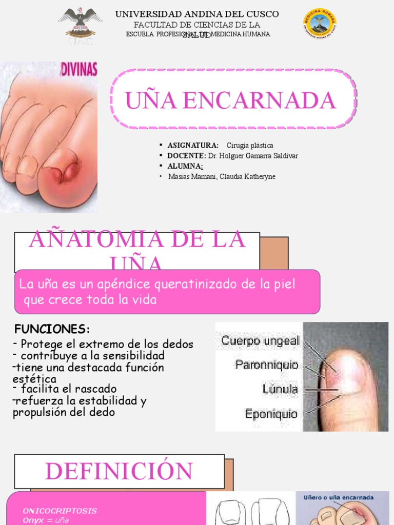 Uña Encarnada | PDF | Clavo (anatomía) | Cirugía