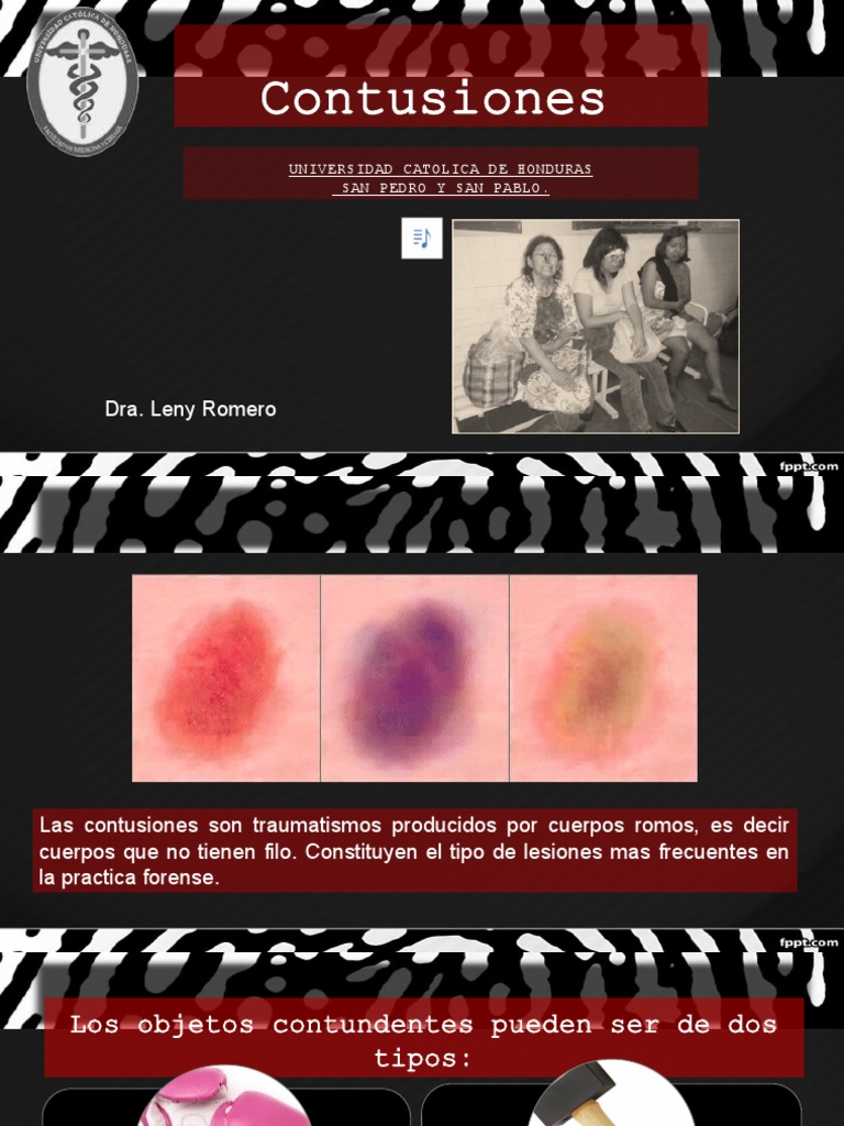 Contusiones | PDF