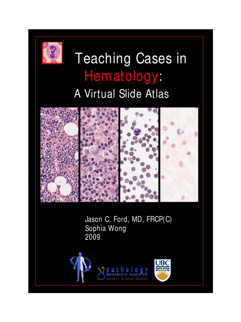 Teaching Cases In: Hematology | PDF