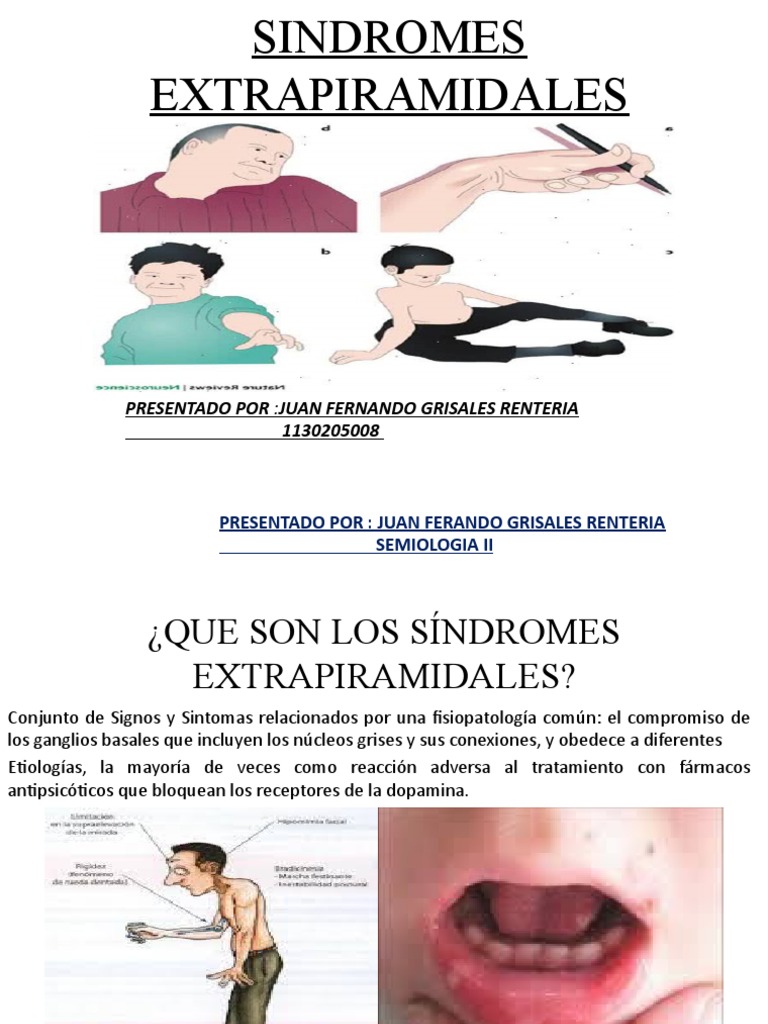 Sindrome Extrapiramidales | PDF | Enfermedad de Parkinson | Ganglios ...