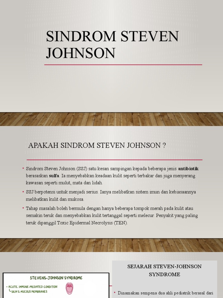 Steven Johnson Syndrom | PDF
