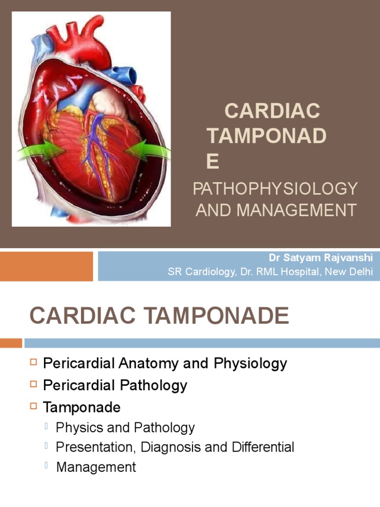 Cardiac Tamponad E: Pathophysiology and Management | PDF | Diastole | Heart