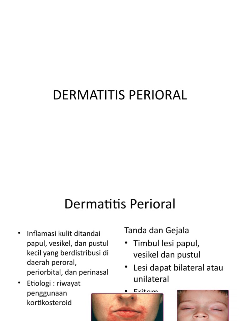 Dermatitis Perioral | PDF