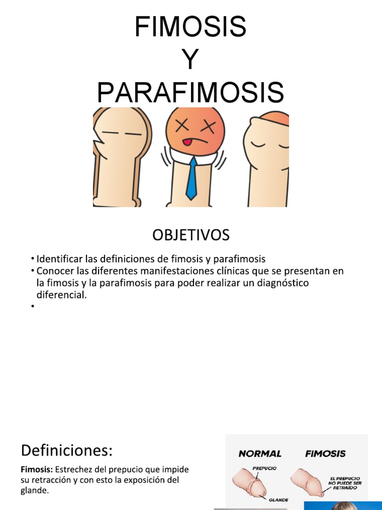 Fimosis y Parafimosis PDF | PDF