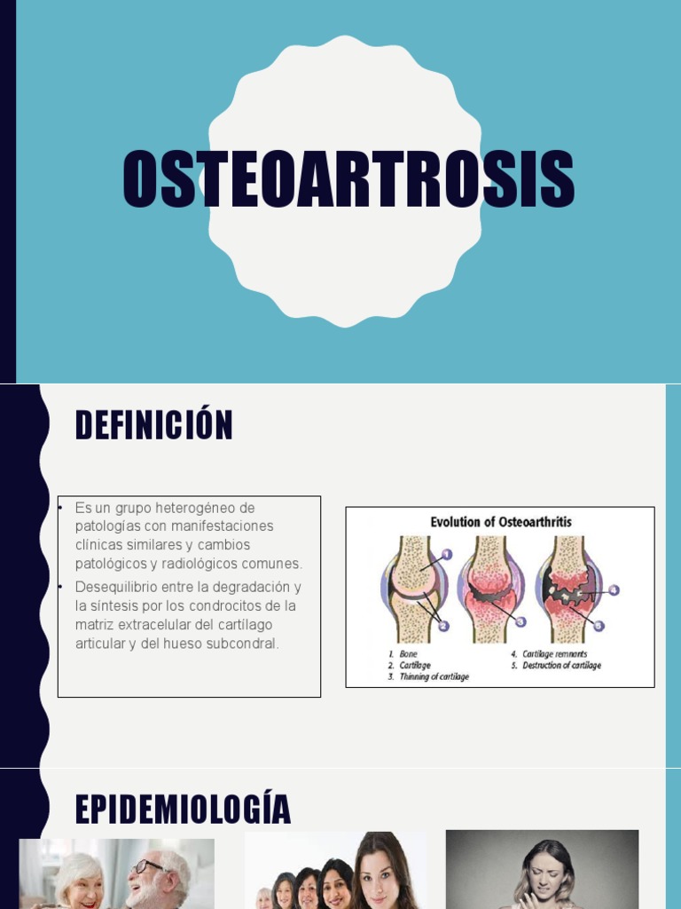 OSTEOARTROSIS | PDF | Ciencia y matemáticas