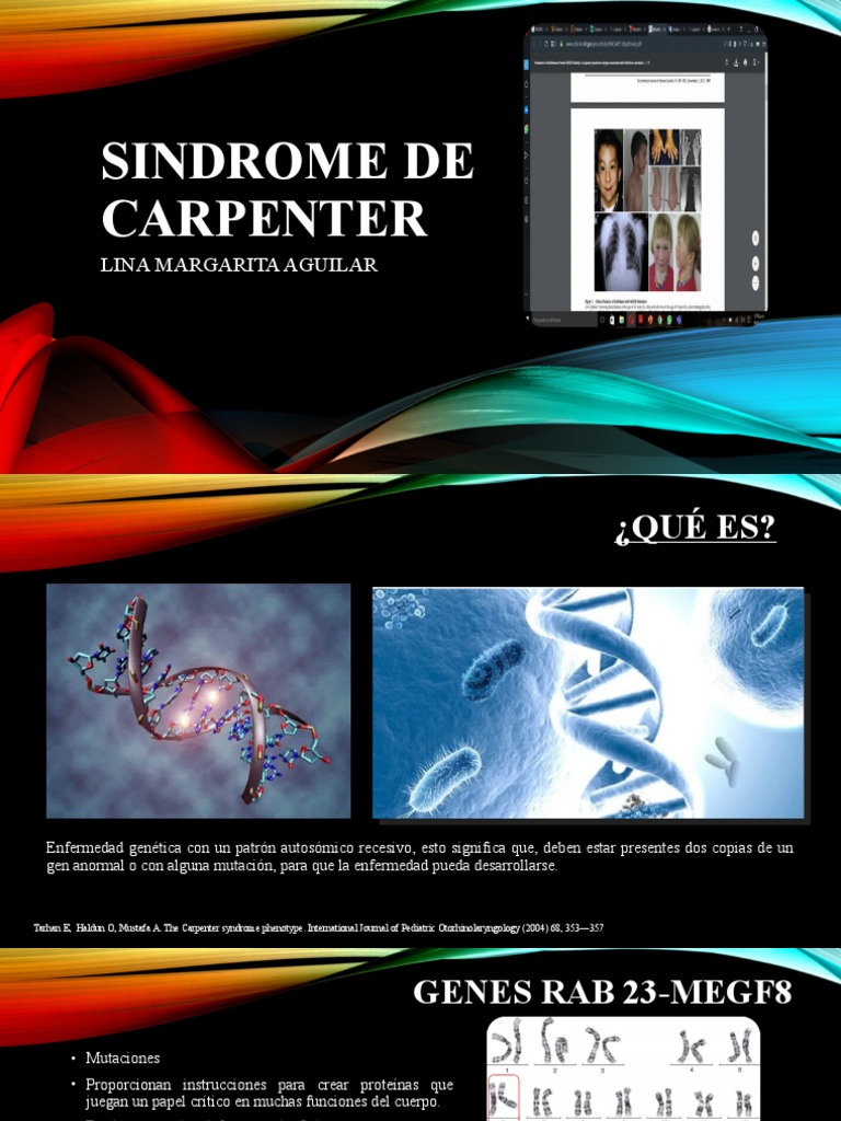 Sindrome de Carpenter Final | PDF | Discapacidad intelectual | Gene