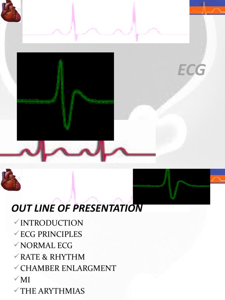 ECG_ THE BASICS | Electrocardiography | Internal Medicine