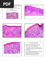 Superficial and Deep Perivascular Dermatitis | PDF | Epidermis | Dermatitis