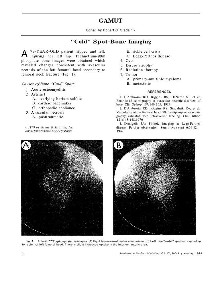 Cold Spot Bone Imaging PDF | PDF | Atrium (Heart) | Congenital Heart Defect