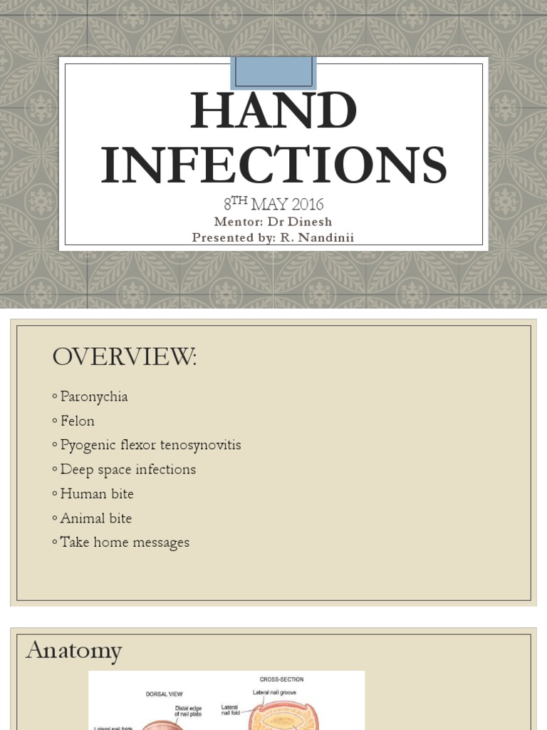 Hand Infections: Mentor: DR Dinesh Presented By: R. Nandinii | PDF ...