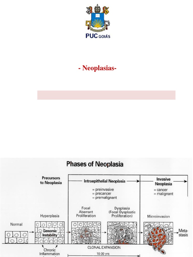 Aula 16 - Tipos de Neoplasias PDF | PDF | Neoplasmas | Câncer