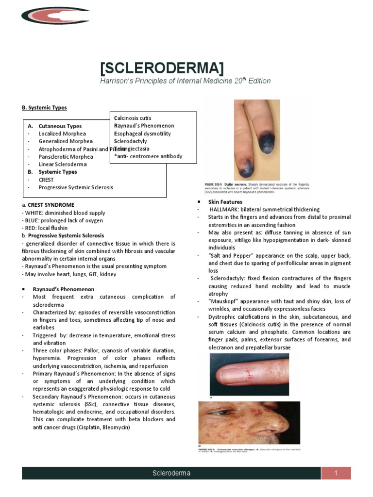 Scleroderma (Harrison's Principle of Internal Medicine) | PDF ...
