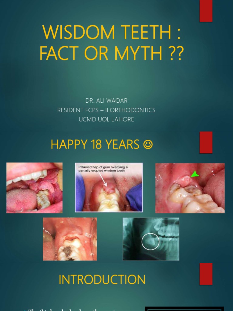 Wisdom Teeth: Fact or Myth ??: Dr. Ali Waqar Resident Fcps - Ii ...