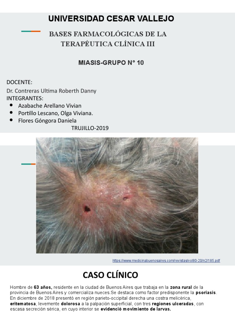 MIASIS | PDF | Inmunología | Especialidades Medicas