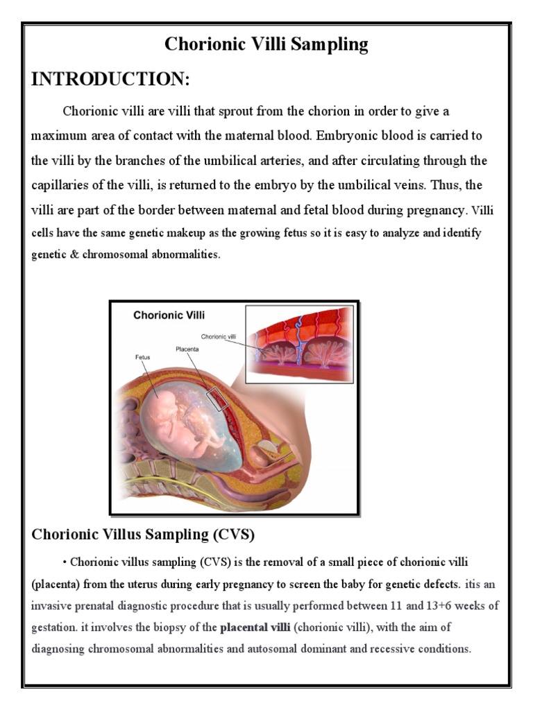 Chorionic | PDF | Genetic Disorder | Fetus