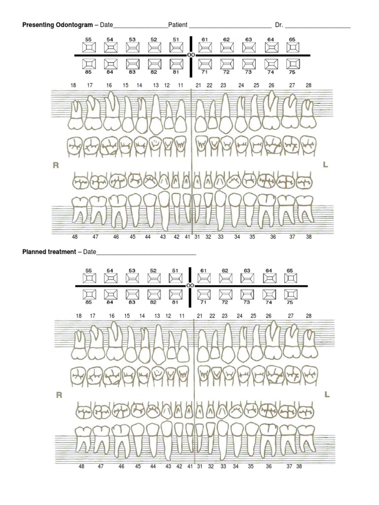 Sample Odontogram Existing and Planned Treatment PDF | PDF