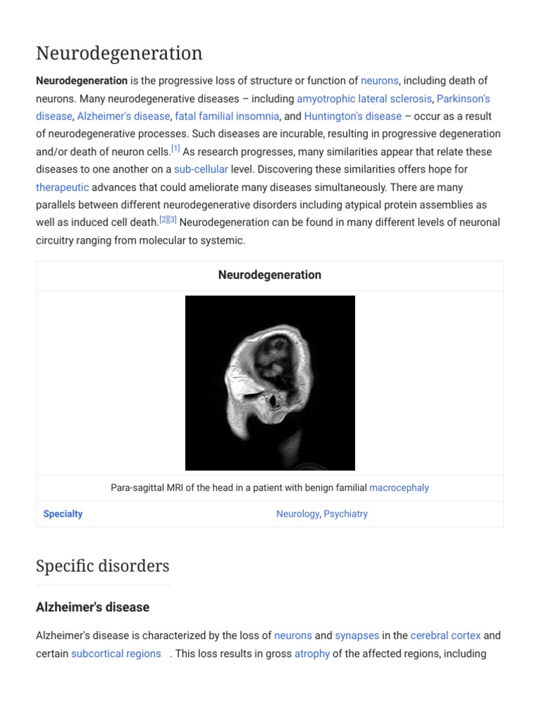 An In-Depth Review of Key Neurodegenerative Diseases: Their Causes ...
