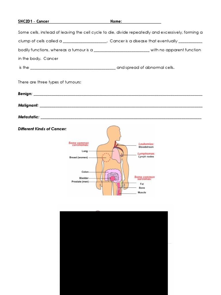 01 Cancer Note | PDF | Metastasis | Cancer