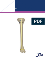 Zimmer Natural Nail System Tibial Nail Surgical Technique | PDF | Screw ...