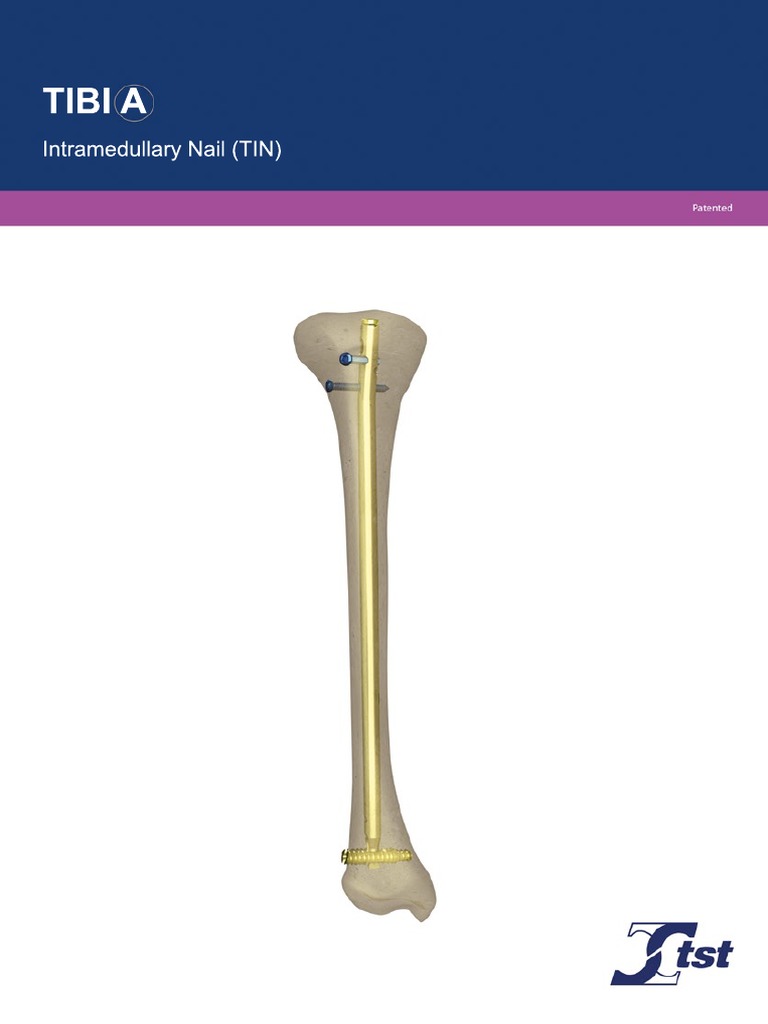 Tibia Intramedullary Nail Overview | PDF