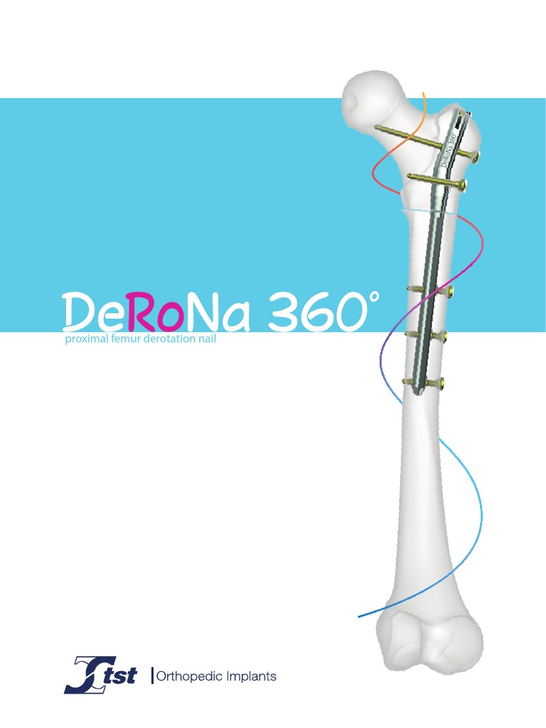 An Accurate Description of the DeRoNa 360° Proximal Femur Derotation ...