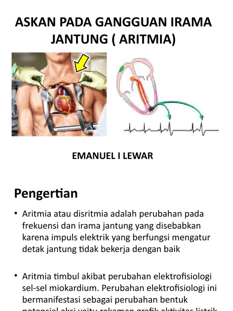 Askan Pada Gangguan Irama Jantung | PDF
