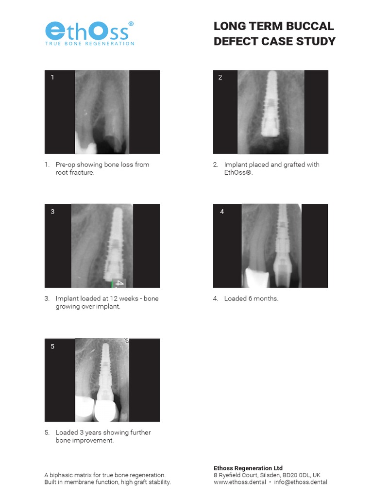 20 Long Term Buccal Defect Case Study PDF | PDF | Home & Garden ...