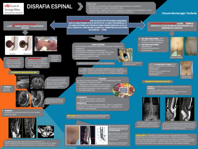 Disrafia Espinal: Tipos y Diagnóstico | PDF | Especialidades Medicas ...
