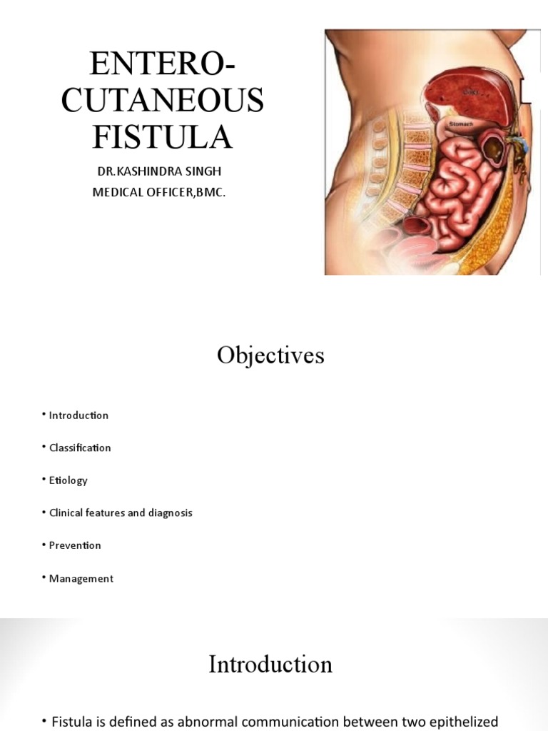 Entero-Cutaneous Fistula Overview | PDF | Crohn's Disease | Sepsis