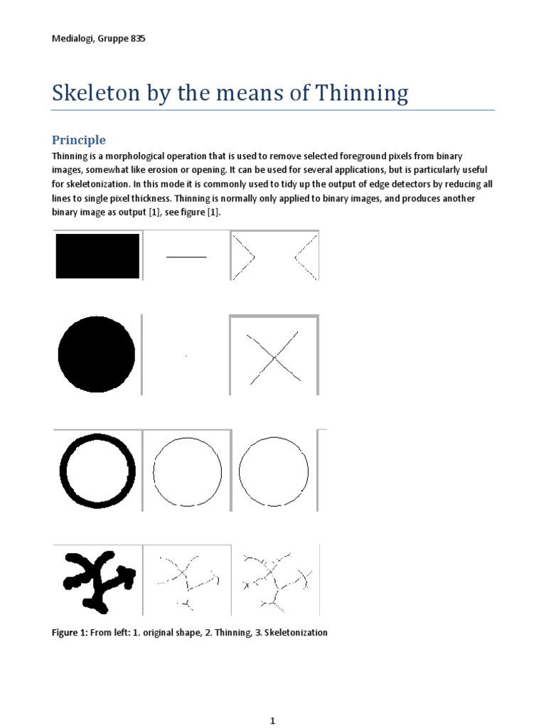 Skeleton by The Means of Thinning: Principle | PDF