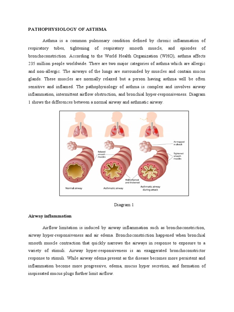 Pathophysiology of Asthma Trigger 1 | PDF
